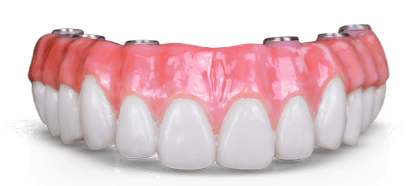 protese protocolo fb - mrodontologiapiracicaba.com.br